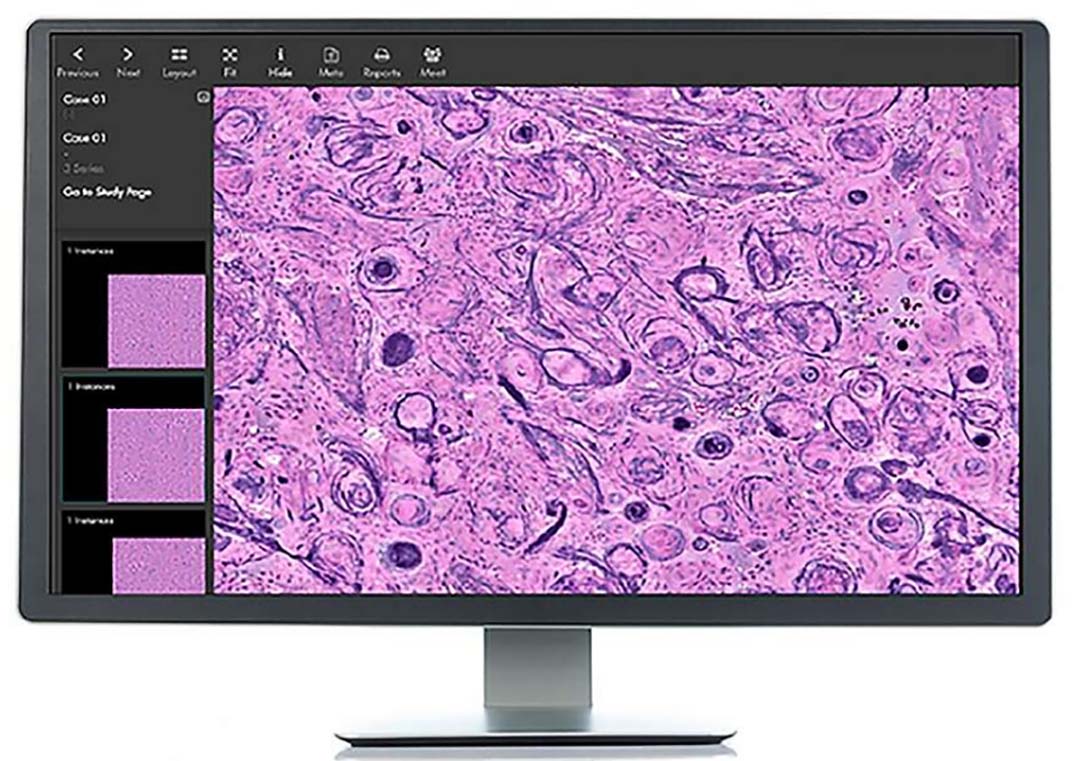 AI analyses cancer cells in the operating room - IT-Online